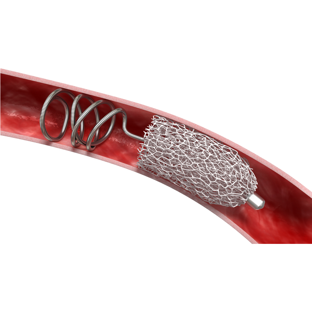 Endovaskuläre Chirurgie - Aimecs